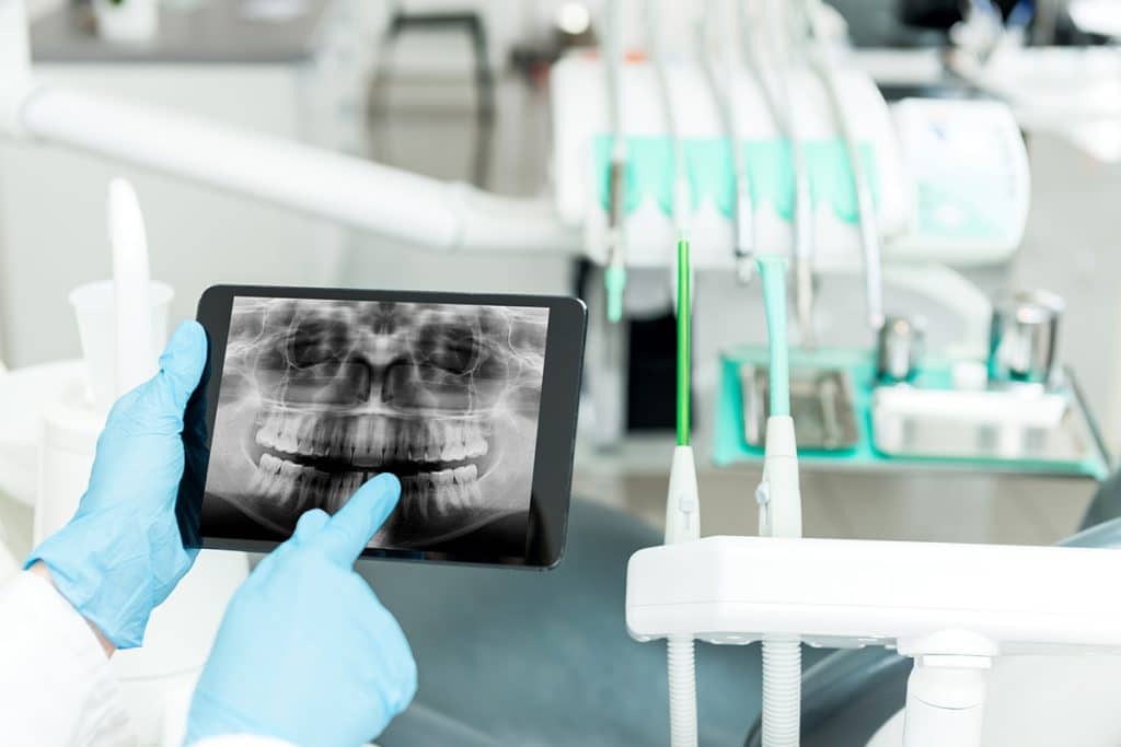 The Role of Digital Dentistry – Dentex Smile Studio
